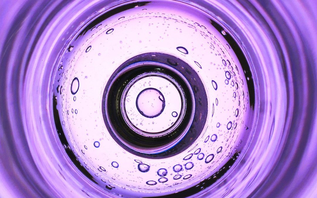 Hypermobility and POTS